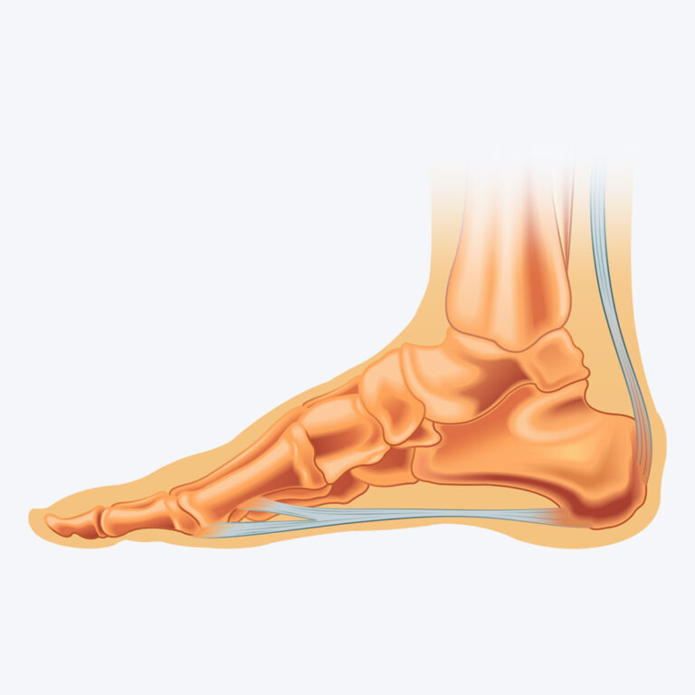 Foot & Ankle Orthopedic Care Albany, NY | OrthoNY